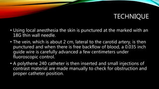 Jugular venography | PPTX | Ear, Nose and Throat Conditions | Diseases ...