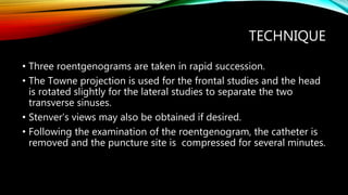 Jugular venography | PPTX