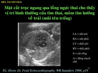 SIÊU ÂM TIM THAI | PDF