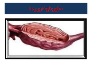 Sasqeso hormonebi | PPT