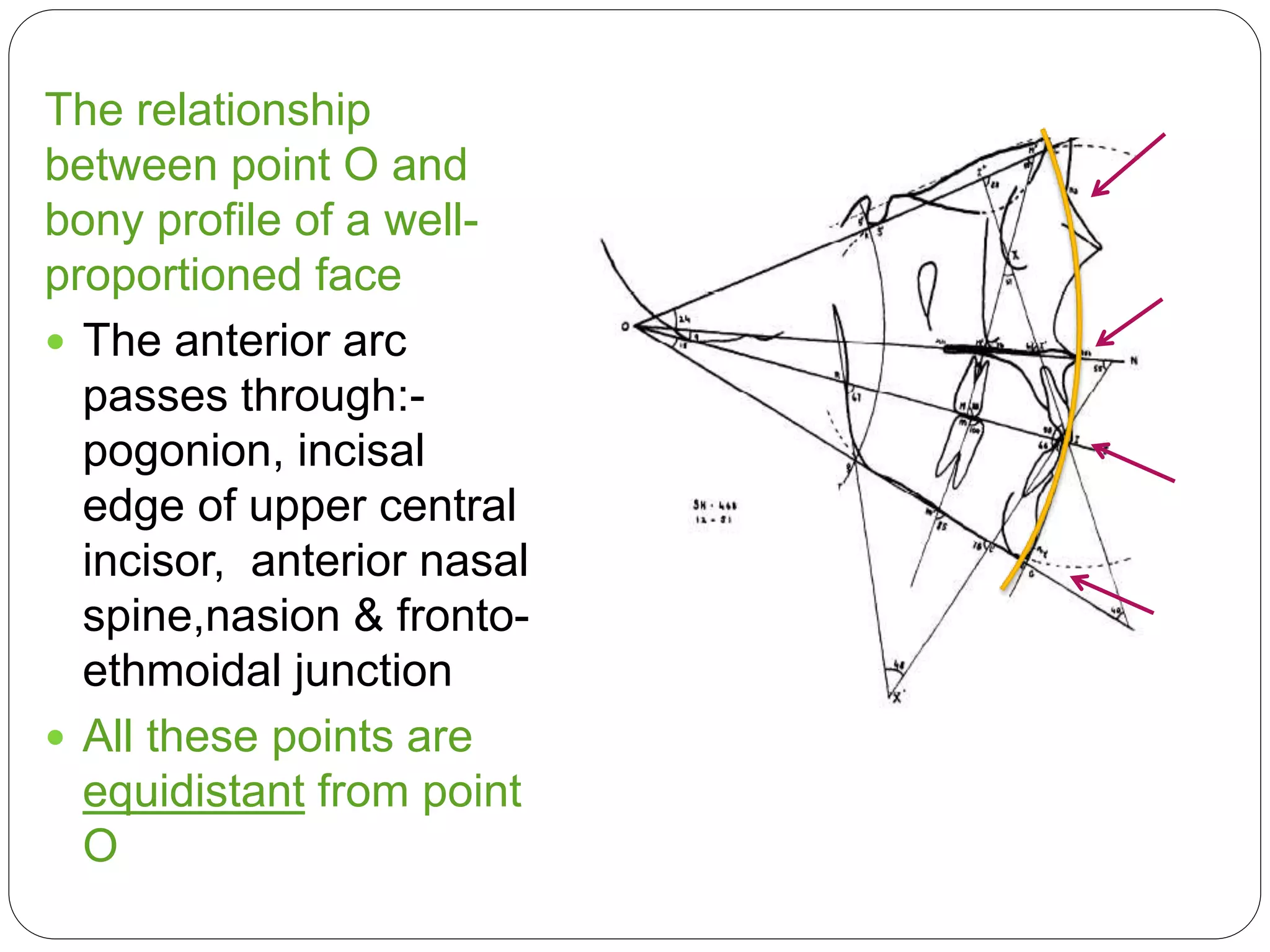 Sassouni's analysis | PPTX