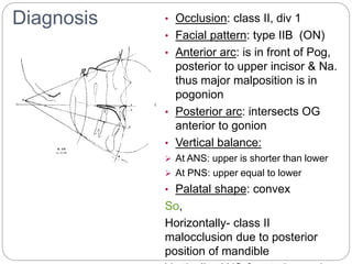 Sassouni's analysis | PPTX