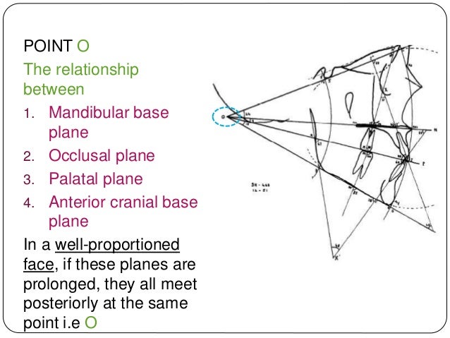 Sassouni's analysis