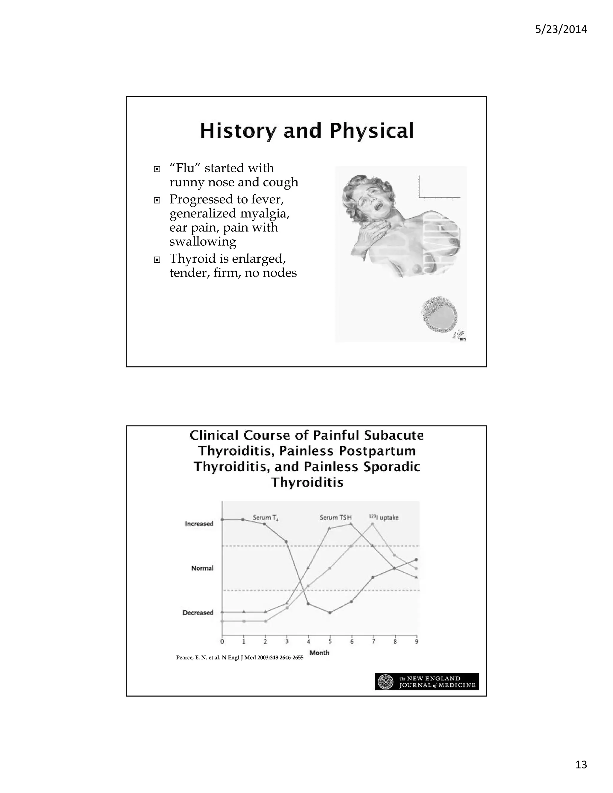 Sat 1420-thyrotoxicosis- -seasons | PDF