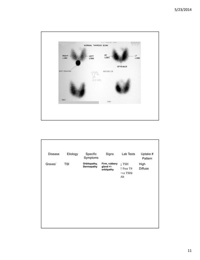 Sat 1420-thyrotoxicosis- -seasons | PDF