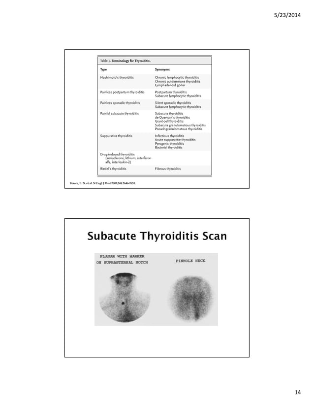 Sat 1420-thyrotoxicosis- -seasons | PDF