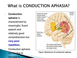 Conduction Aphasia