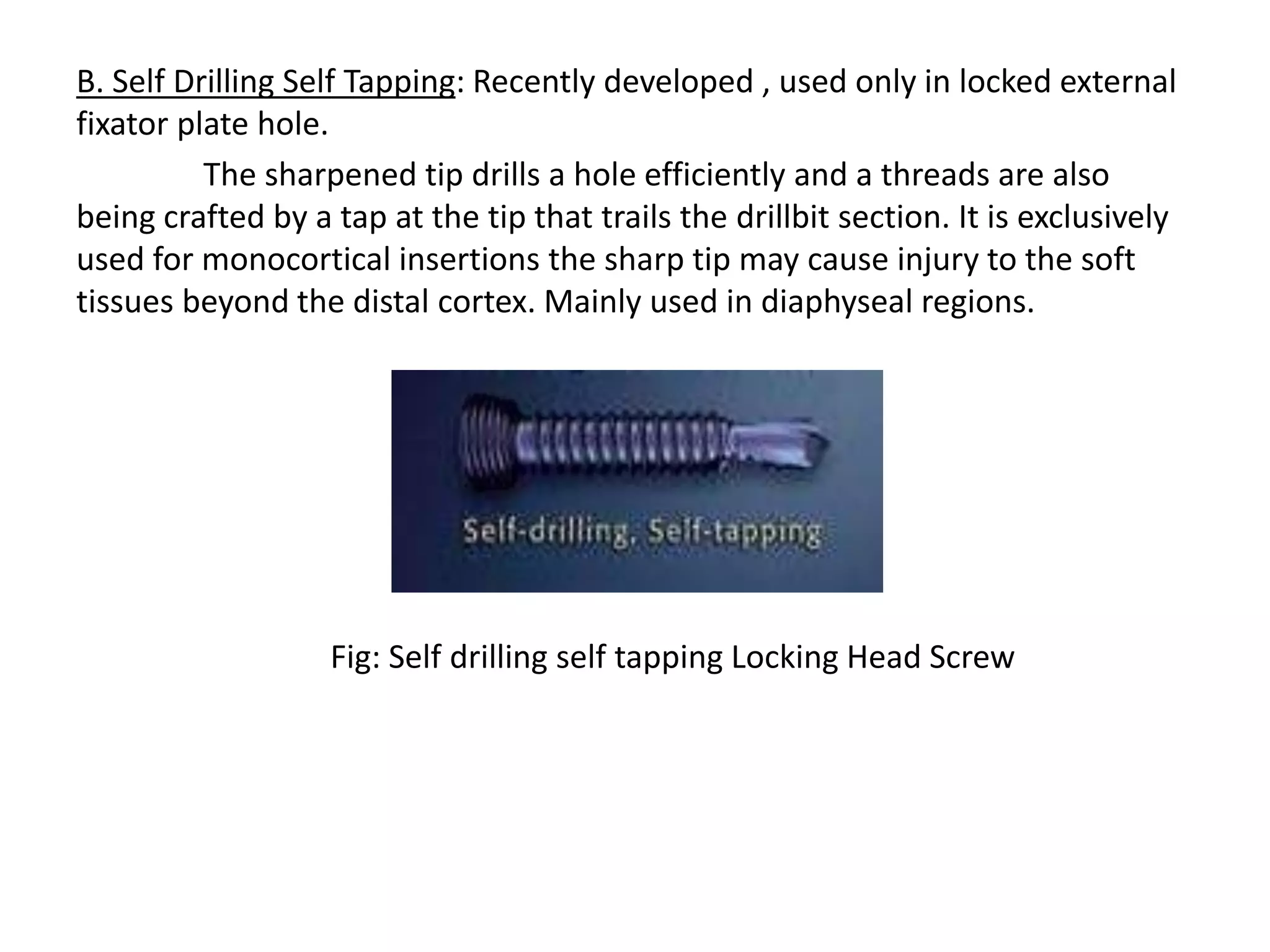 Anatomy of a bone screw, cortical screw vs cancellous screw, wood screw ...