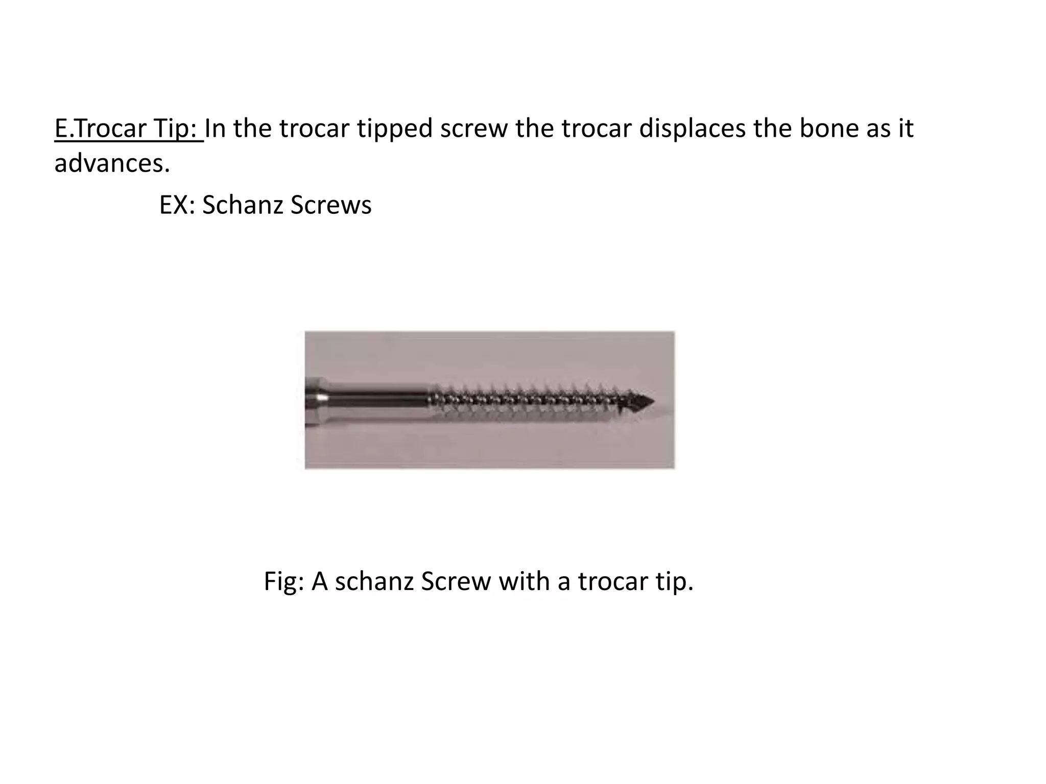 Anatomy of a bone screw, cortical screw vs cancellous screw, wood screw ...