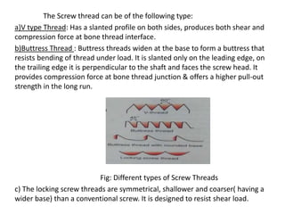 Anatomy of a bone screw, cortical screw vs cancellous screw, wood screw ...