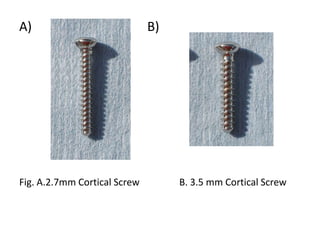 Anatomy of a bone screw, cortical screw vs cancellous screw, wood screw ...