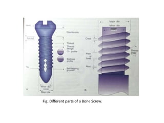 Anatomy of a bone screw, cortical screw vs cancellous screw, wood screw ...