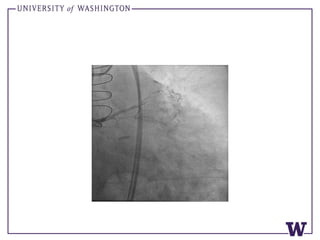 Saturday 1030 – lombardi dissection re-entry | PDF