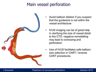 Saturday 1203 – escaned coronary perforations | PPT