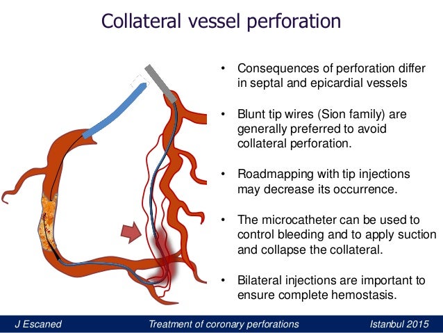 Saturday 1203 – escaned coronary perforations