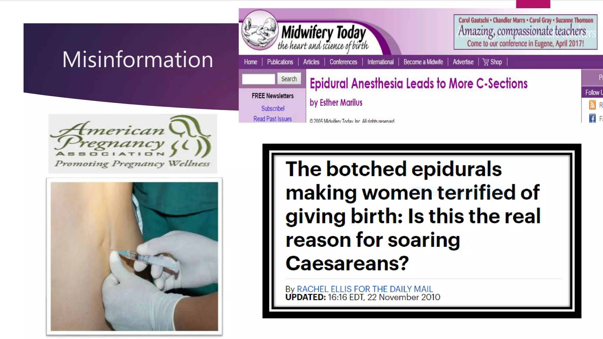 Improving the quality of patient information about labor epidural ...