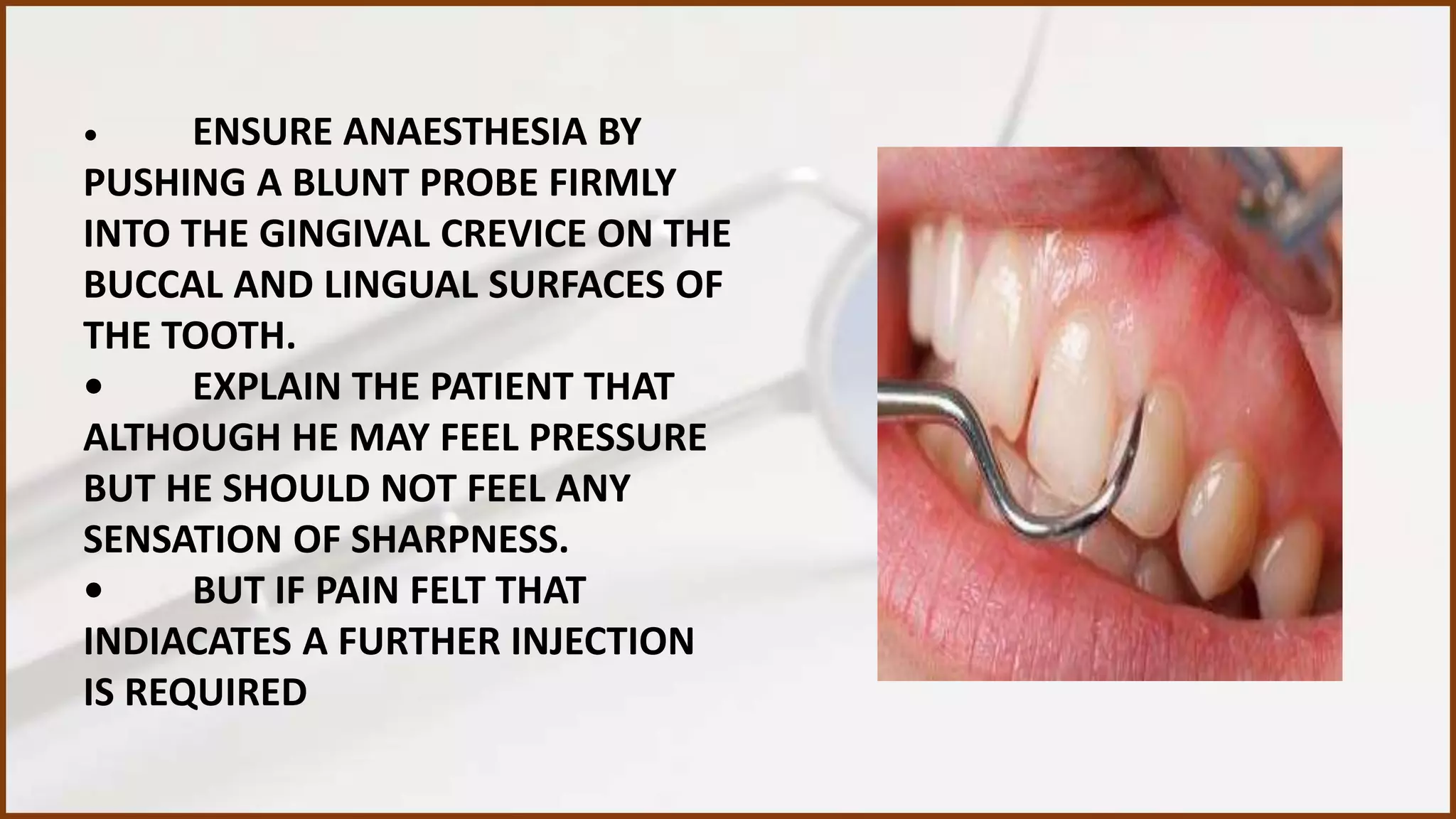 Complication of Tooth extraction and management | PPTX