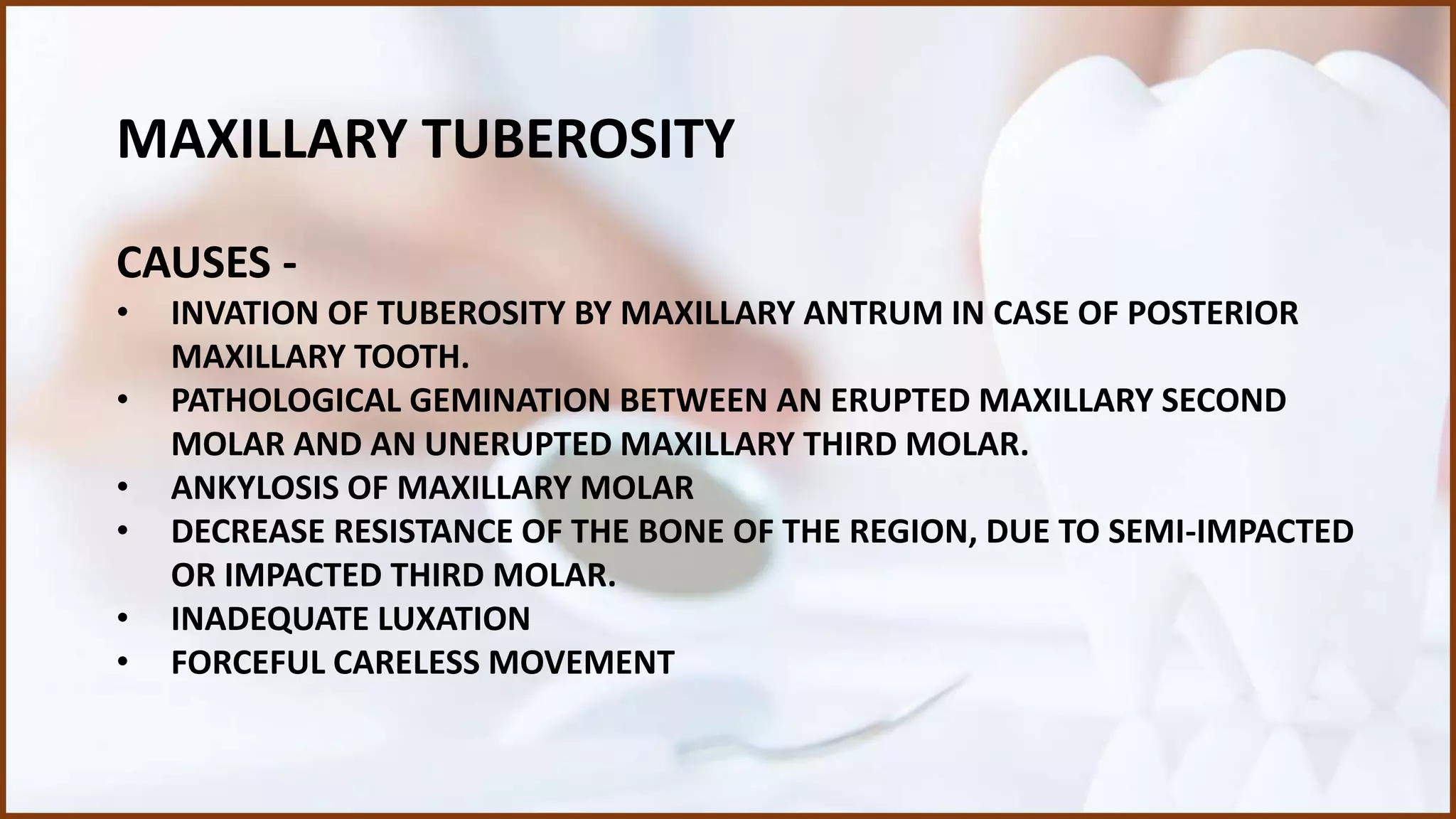 Complication of Tooth extraction and management | PPTX