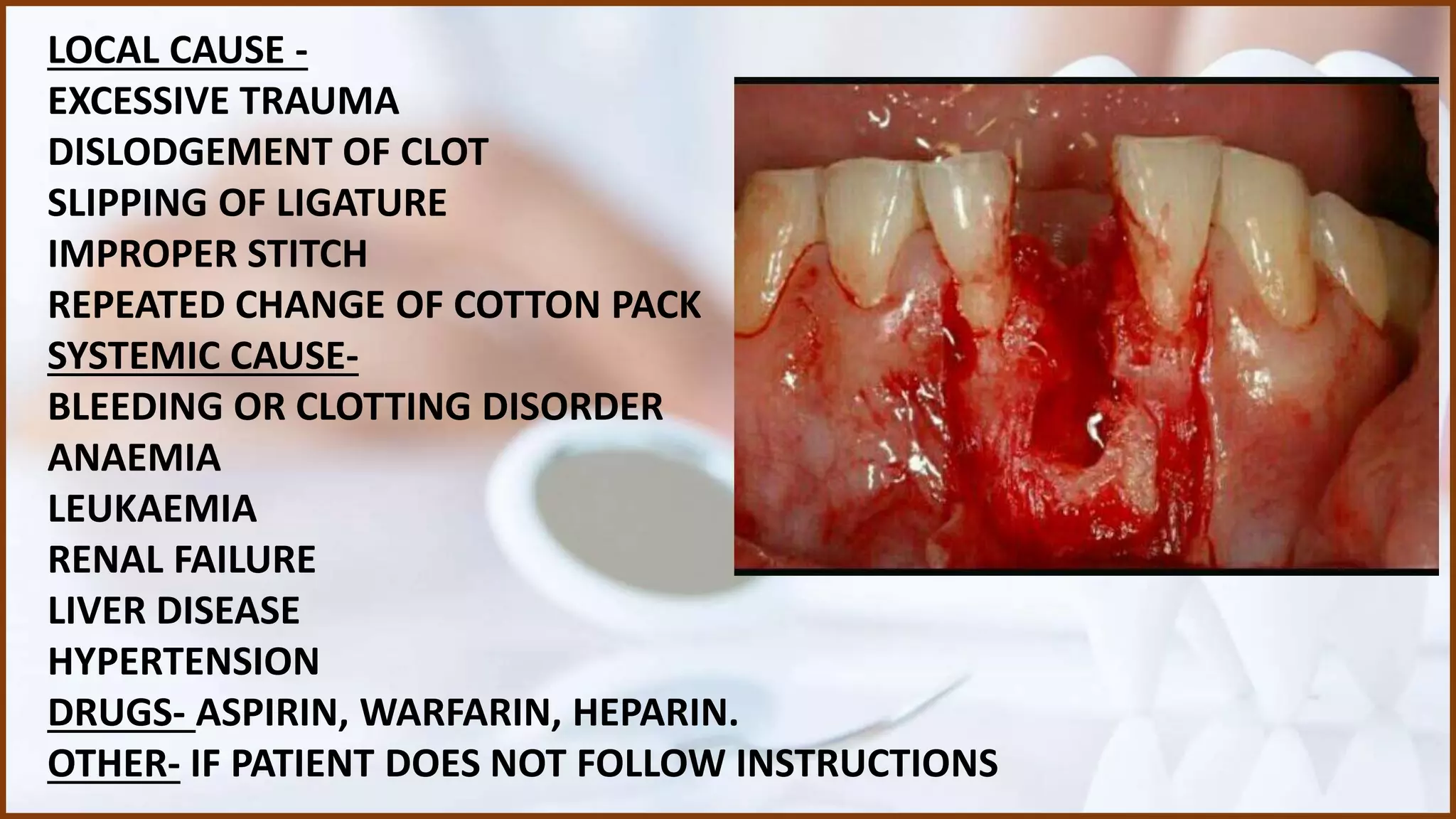 Complication of Tooth extraction and management | PPTX