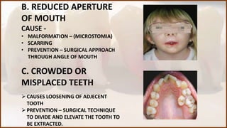Complication of Tooth extraction and management | PPTX