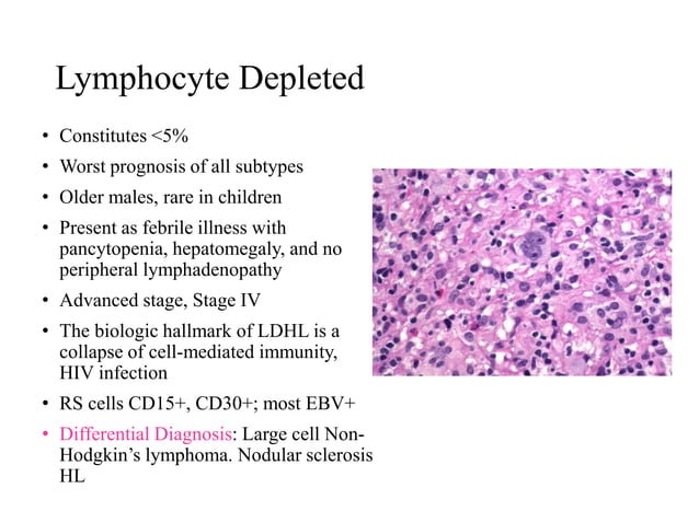 Hodgkin’s lymphoma | PPTX