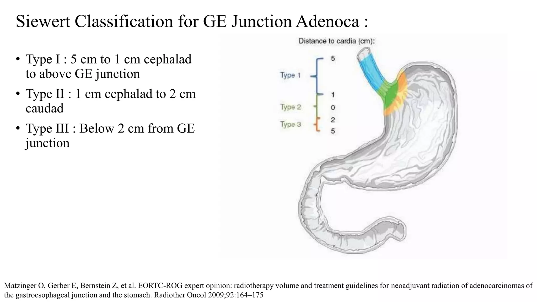 Satyajeet oesophagus management | PPTX