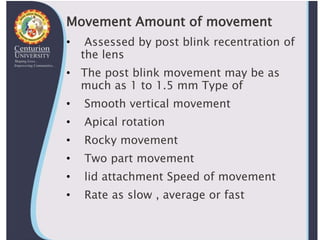 RGP contact lens fitting | PPTX