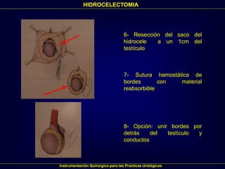 sau2012-instrumentacion-presentacion (1).ppt