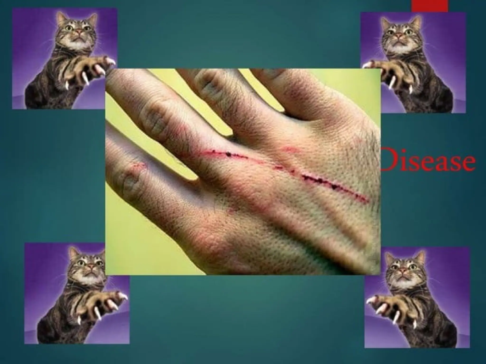 saumya raj, 73A, infectious diseases, topic-felinosis or cat scratch ...