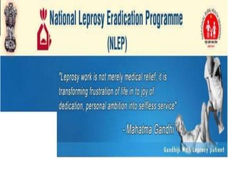 Saurabh - NLEP.pptx