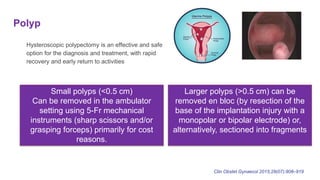 SAVE THE UTERUS | PPTX
