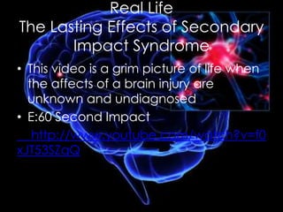 Concussion Awareness | PPTX