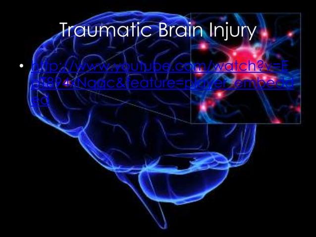 Concussion Awareness | PPTX