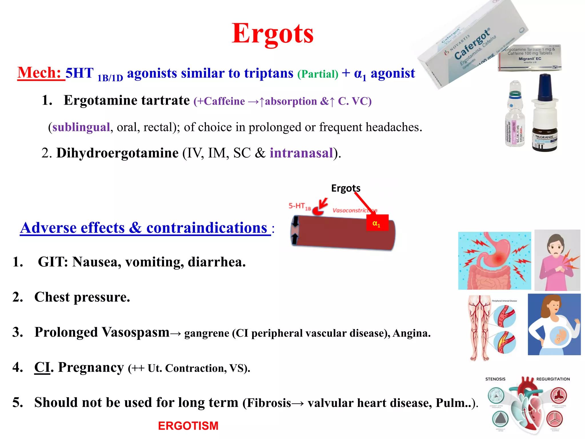 Pathophysiology and Drug Therapy of Migraine | PDF