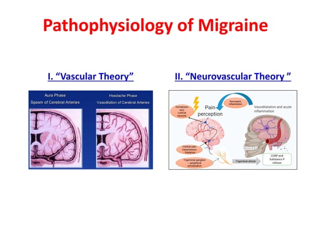 Pathophysiology and Drug Therapy of Migraine | PDF