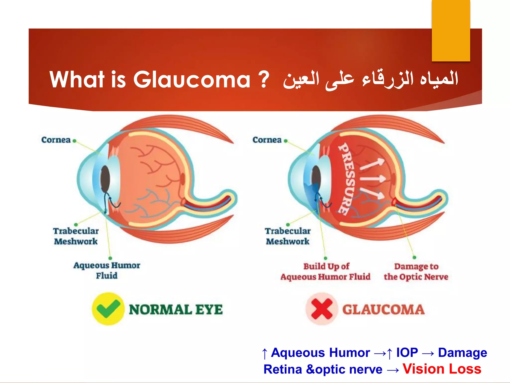 Drug Therapy of Glaucoma | PDF