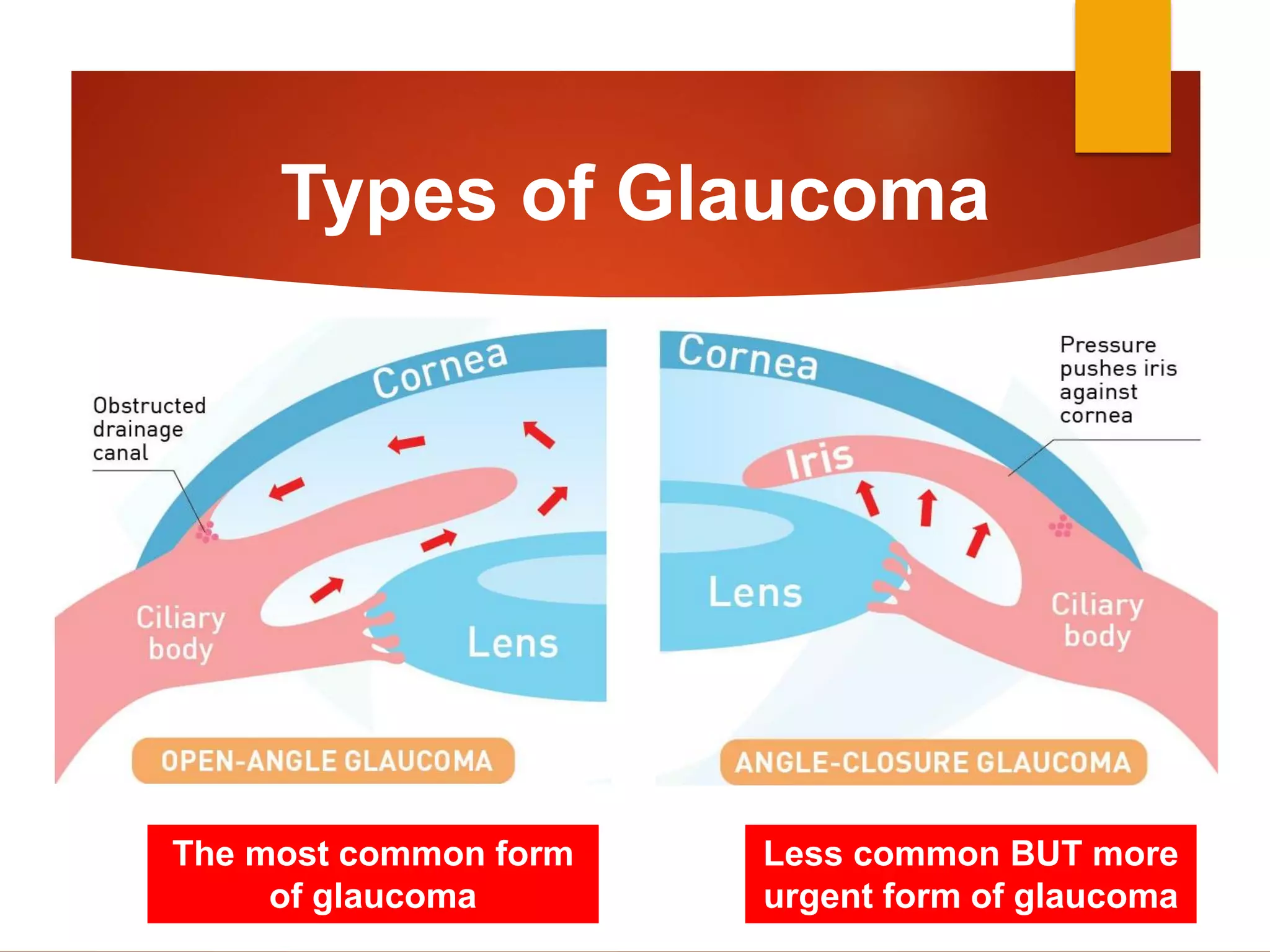 Drug Therapy of Glaucoma | PDF