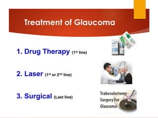 Drug Therapy of Glaucoma | PDF