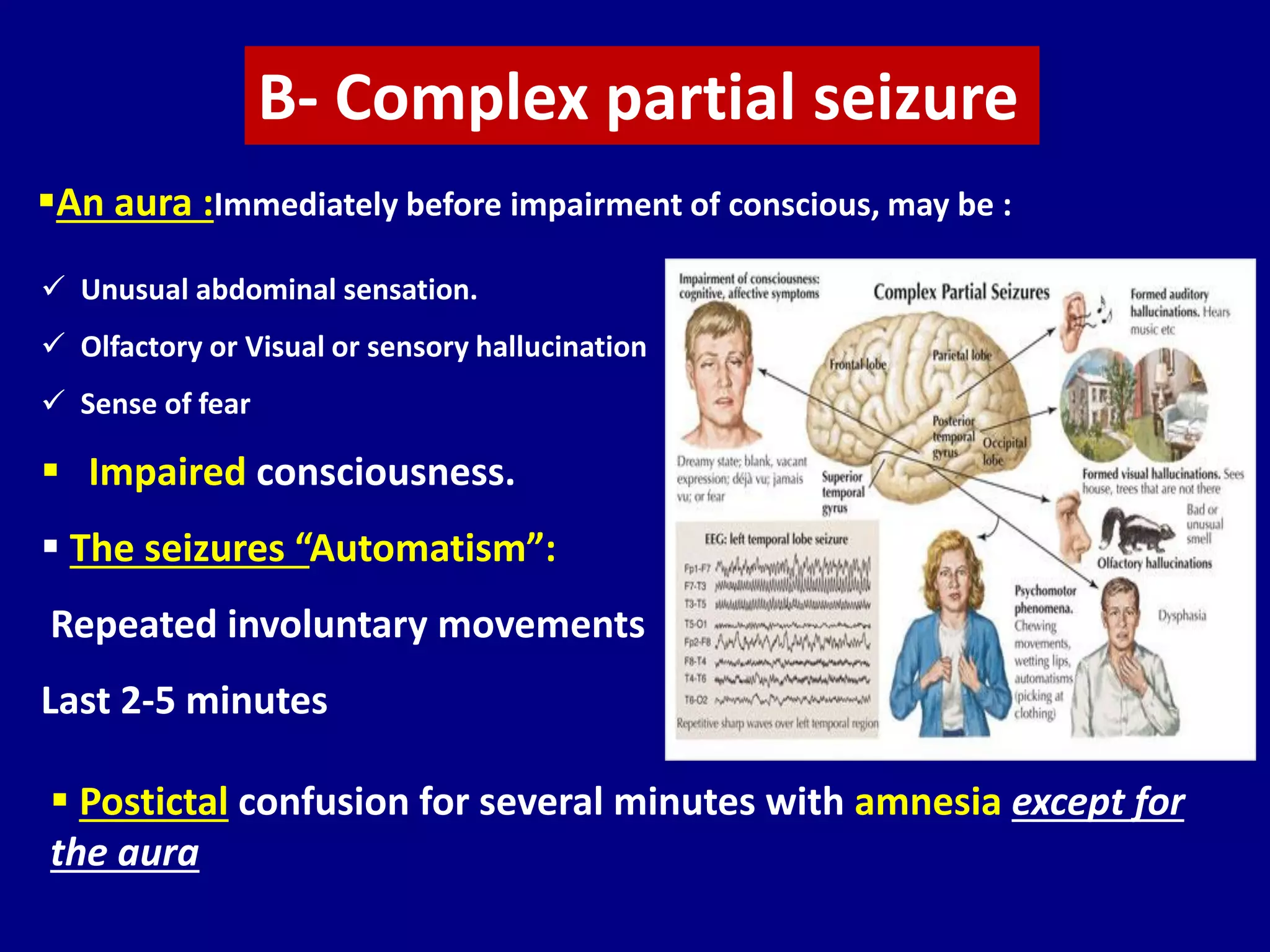 Types of Epilepsy and Choice of Antiepileptics in different Seizures | PDF