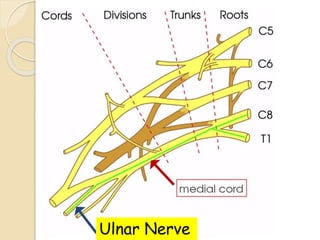 Peripheral Nerves of Upper Limb [Radial, Median & Ulnar nerve] | PPTX