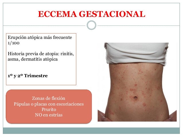 Sábado 8 dermatopatías y embarazo