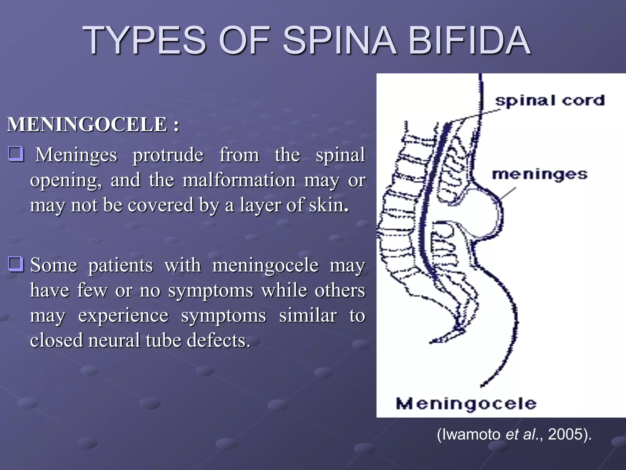 ALPHA FETO PROTEIN: A BIOMAKER OF SPINA BIFIA | PPTX