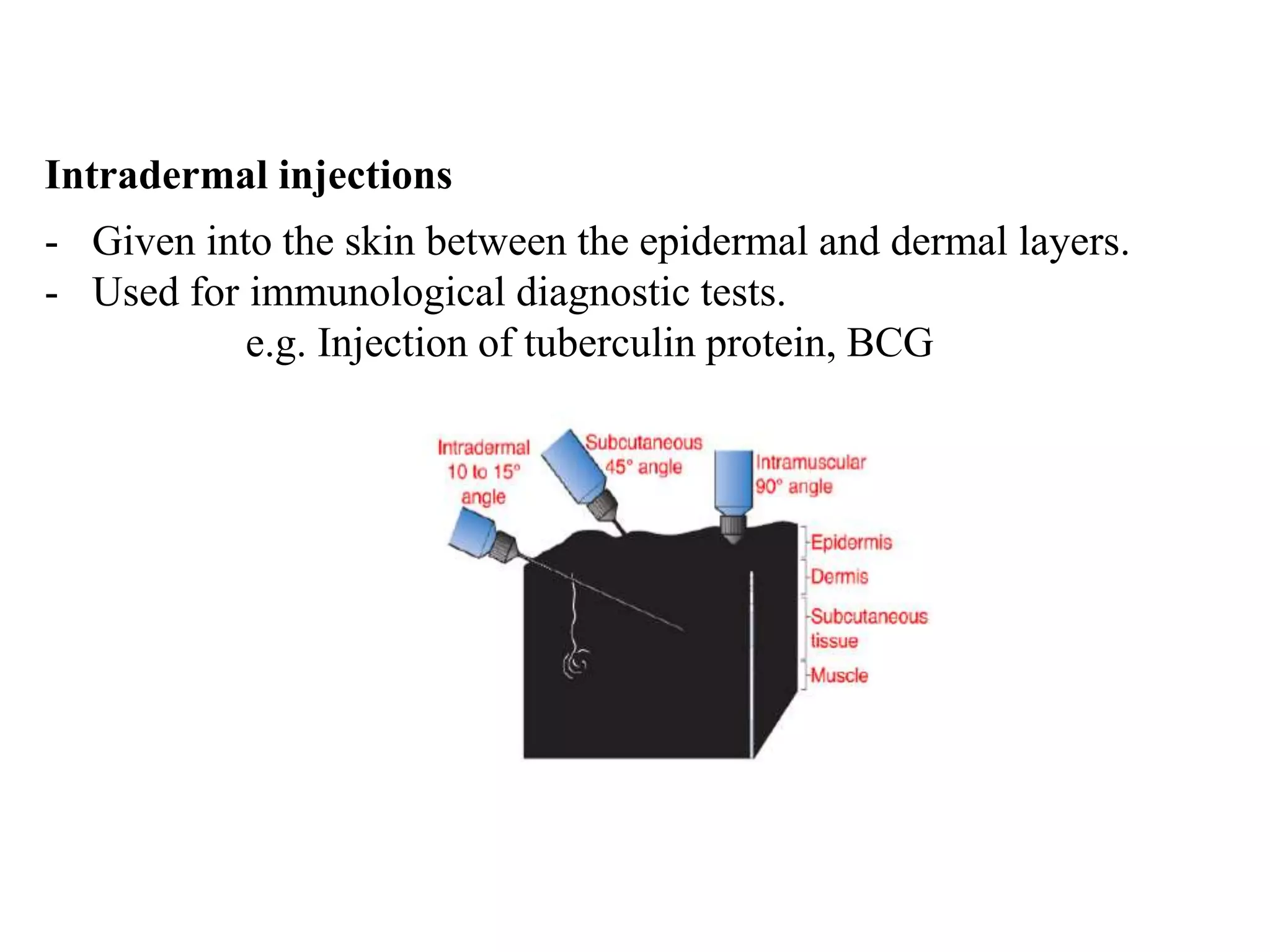 PARENTERAL DRUG DELIVERY SYSTEM | PPTX