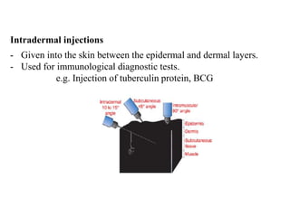 PARENTERAL DRUG DELIVERY SYSTEM | PPTX