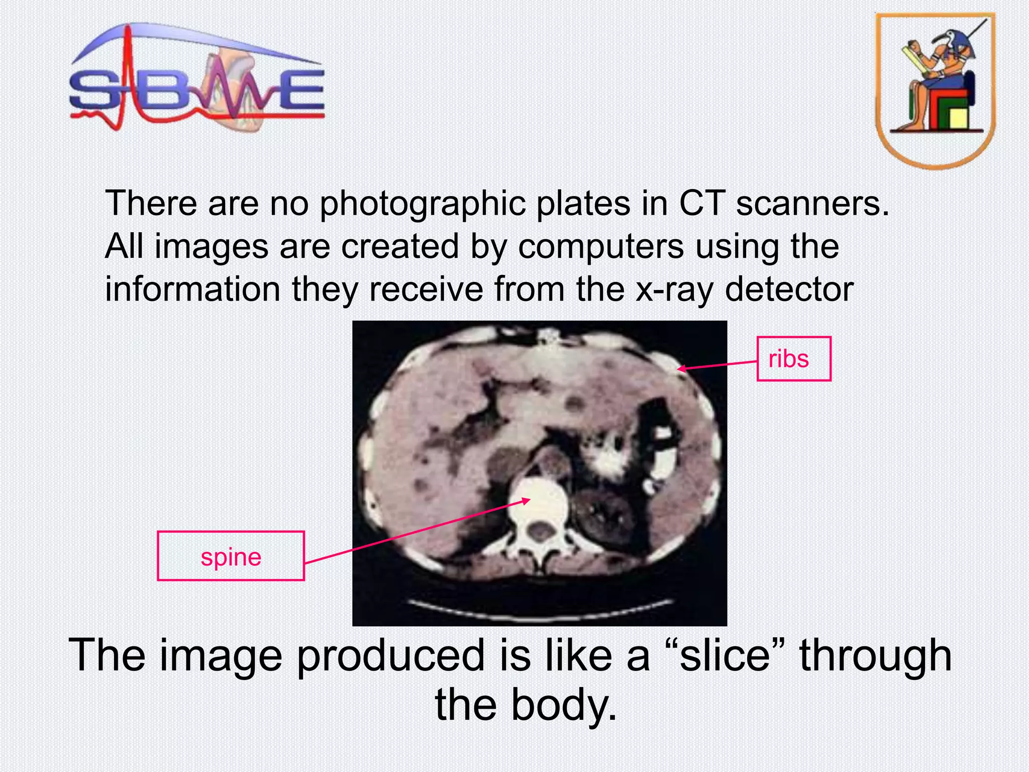 medical equipment lec 5 CT scan | PPT