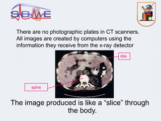 medical equipment lec 5 CT scan | PPT