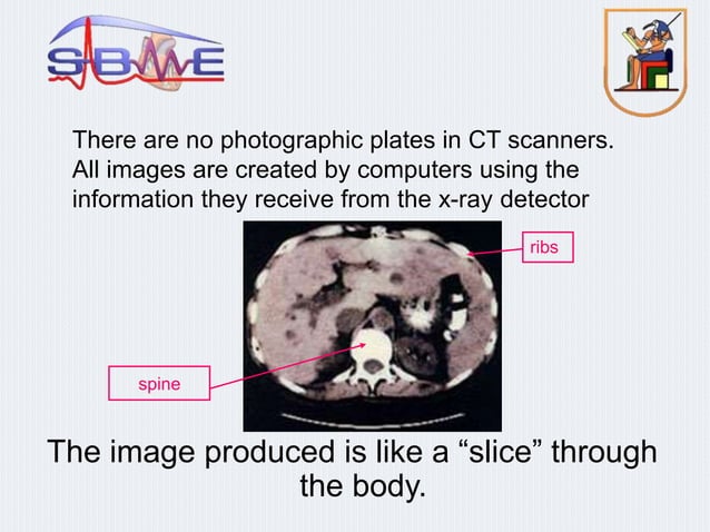 medical equipment lec 5 CT scan | PPT