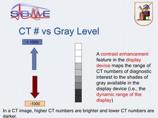 medical equipment lec 6 CT scan | PPTX