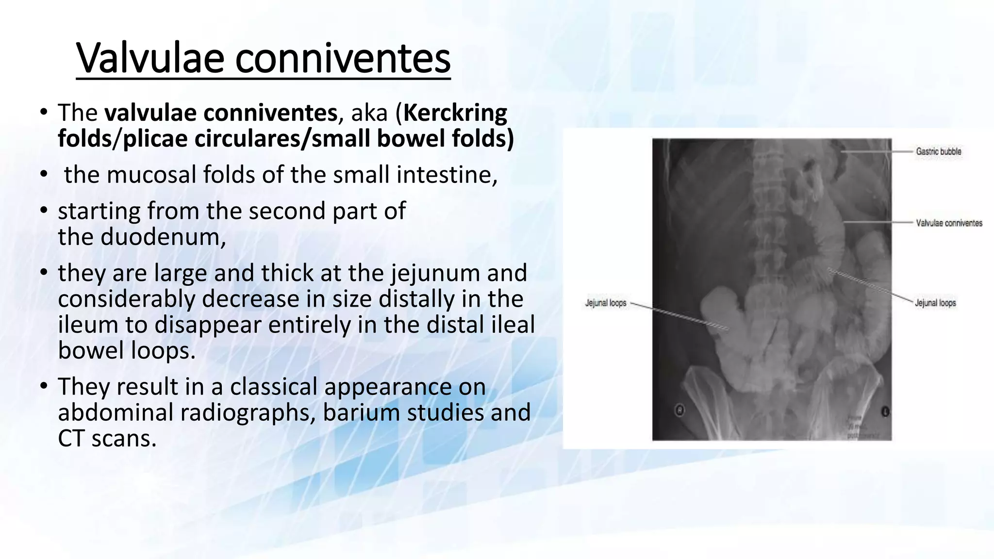RADIOLOGIC ANATOMY OF SMALL INTESTINE AND INTRODUCTION TO SMALL BOWEL ...