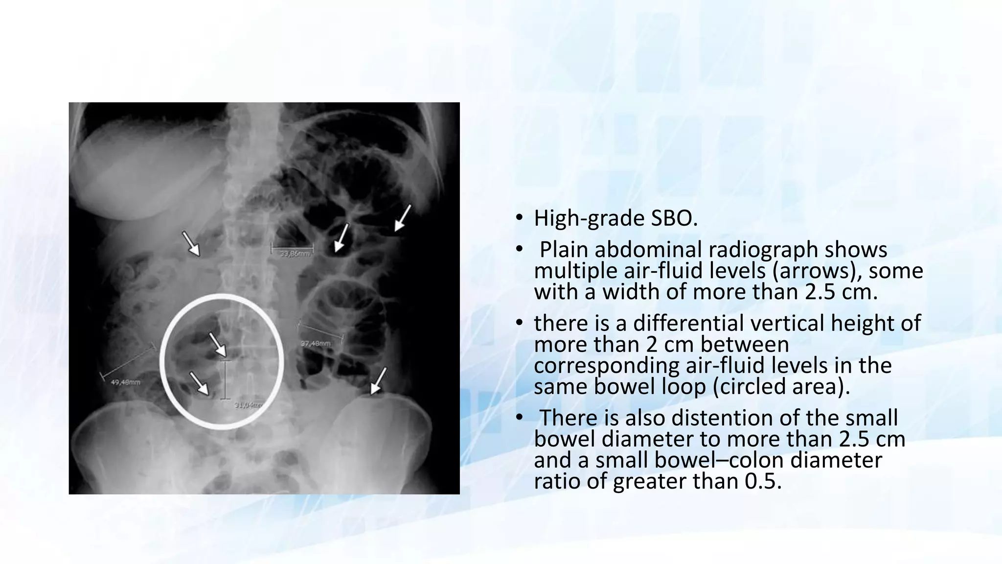 RADIOLOGIC ANATOMY OF SMALL INTESTINE AND INTRODUCTION TO SMALL BOWEL ...